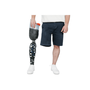 Revolutionizing Mobility: Exploring the World of 3D-Printed Prosthetic ...