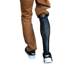 Revolutionizing Mobility: Exploring the World of 3D-Printed Prosthetic ...
